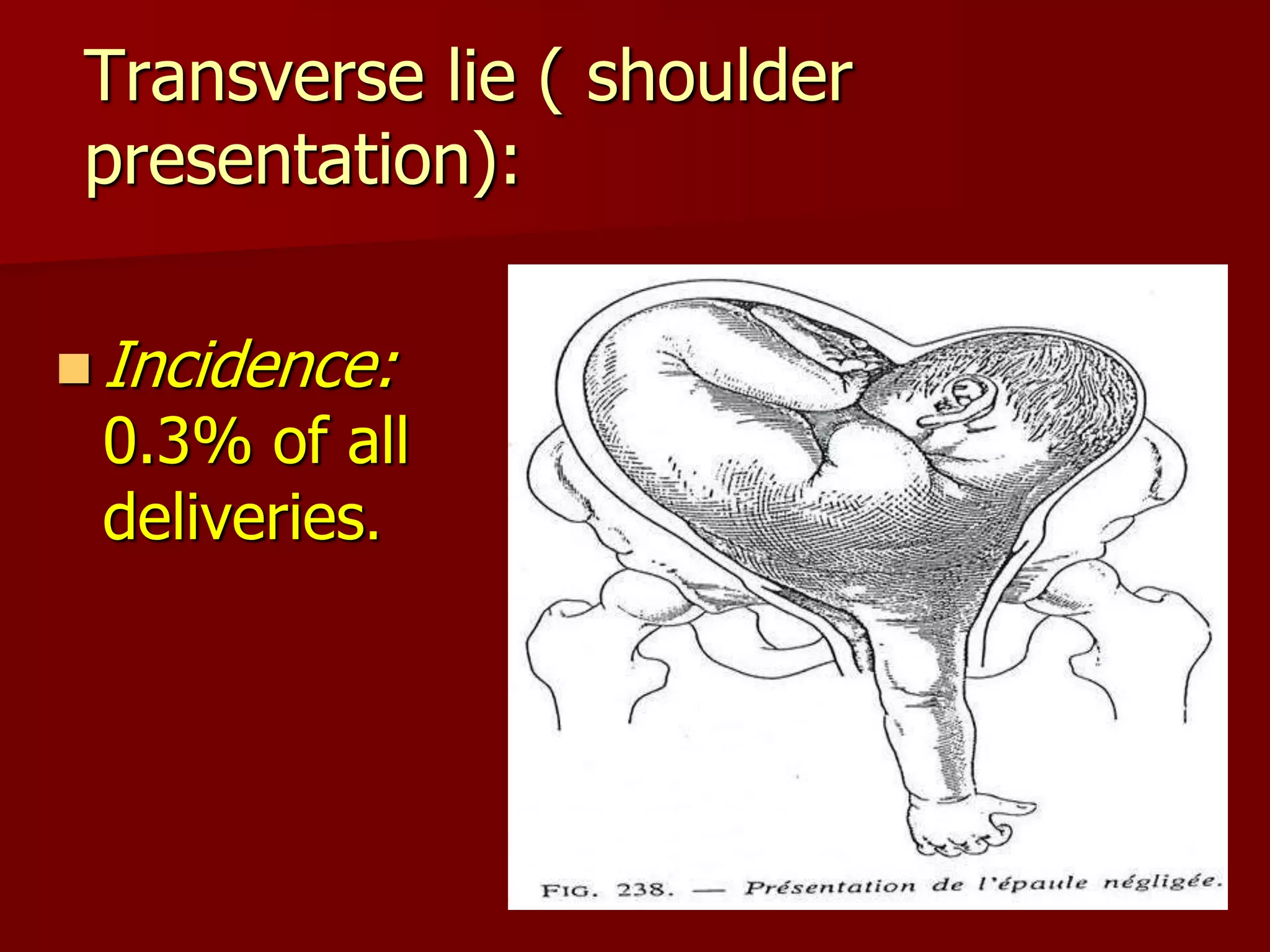 Breech Presentation & transverse lie.ppt