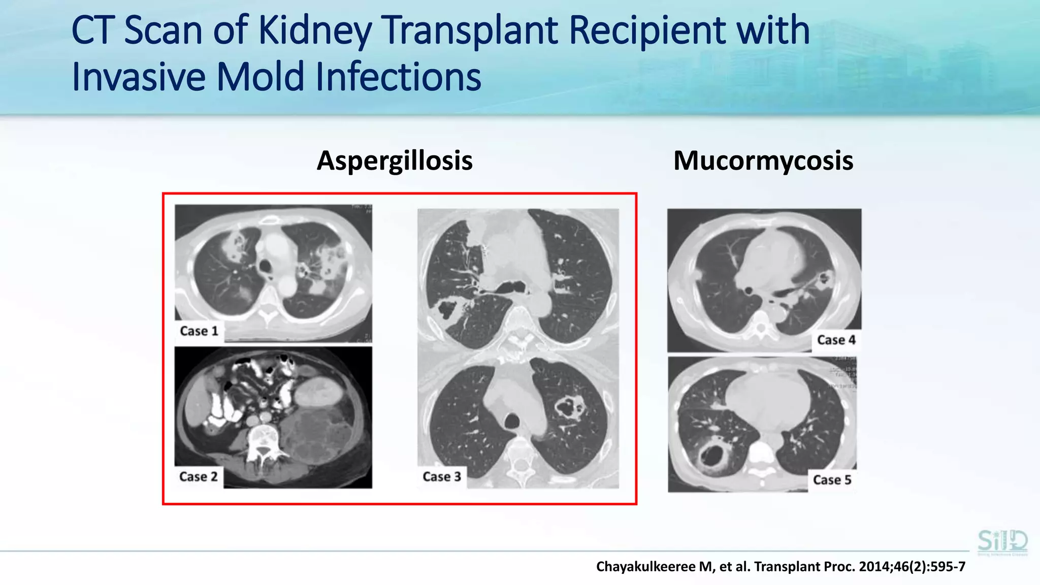 Methee_Chayakulkeeree.pptx