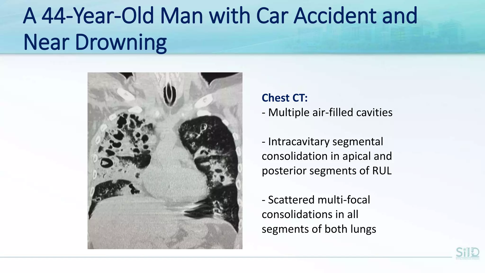 Methee_Chayakulkeeree.pptx | Free Download