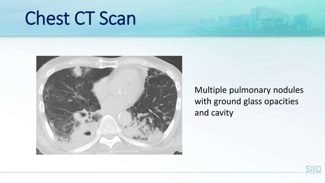 Methee_Chayakulkeeree.pptx | Free Download
