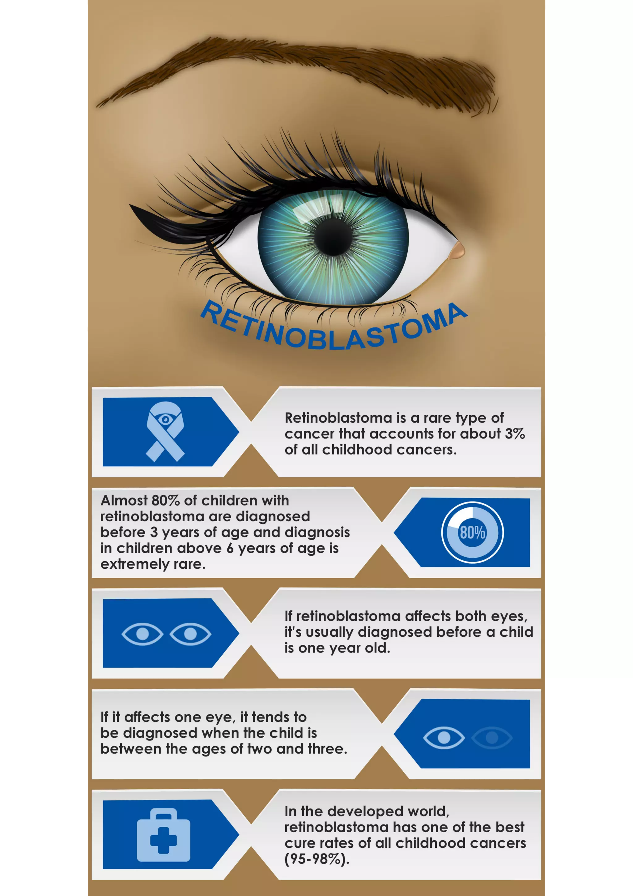Retinoblastoma Facts | PDF