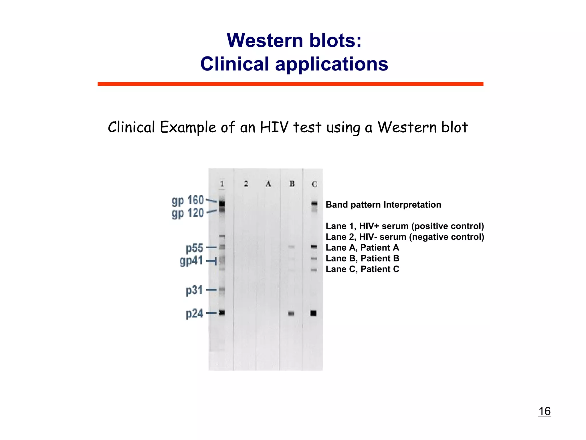 Brian_Strahl 2013_class_on_genomics_and_proteomics | PPT