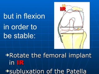 Briard Jl. How To Correct Extra Articular Deformity. Slide 15 26 | PPT