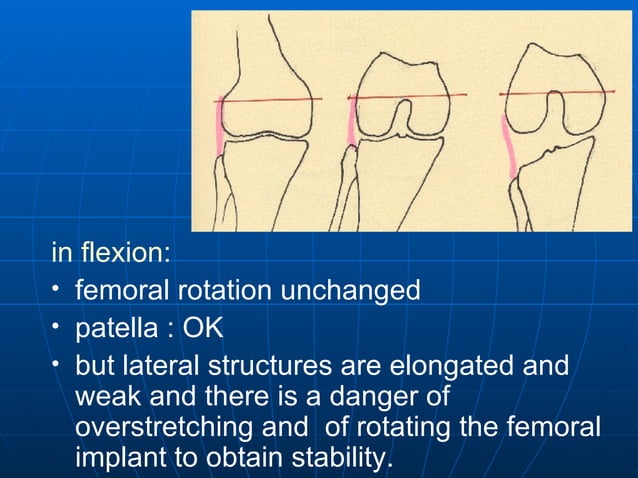 Briard Jl. How To Correct Extra Articular Deformity. Slide 27 40 | PPT