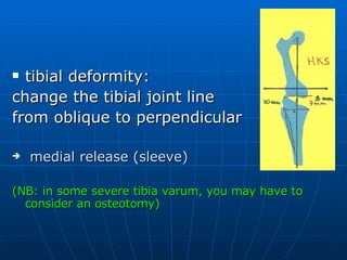 Briard Jl. How To Correct Extra Articular Deformity. Slide 7 14 | PPT