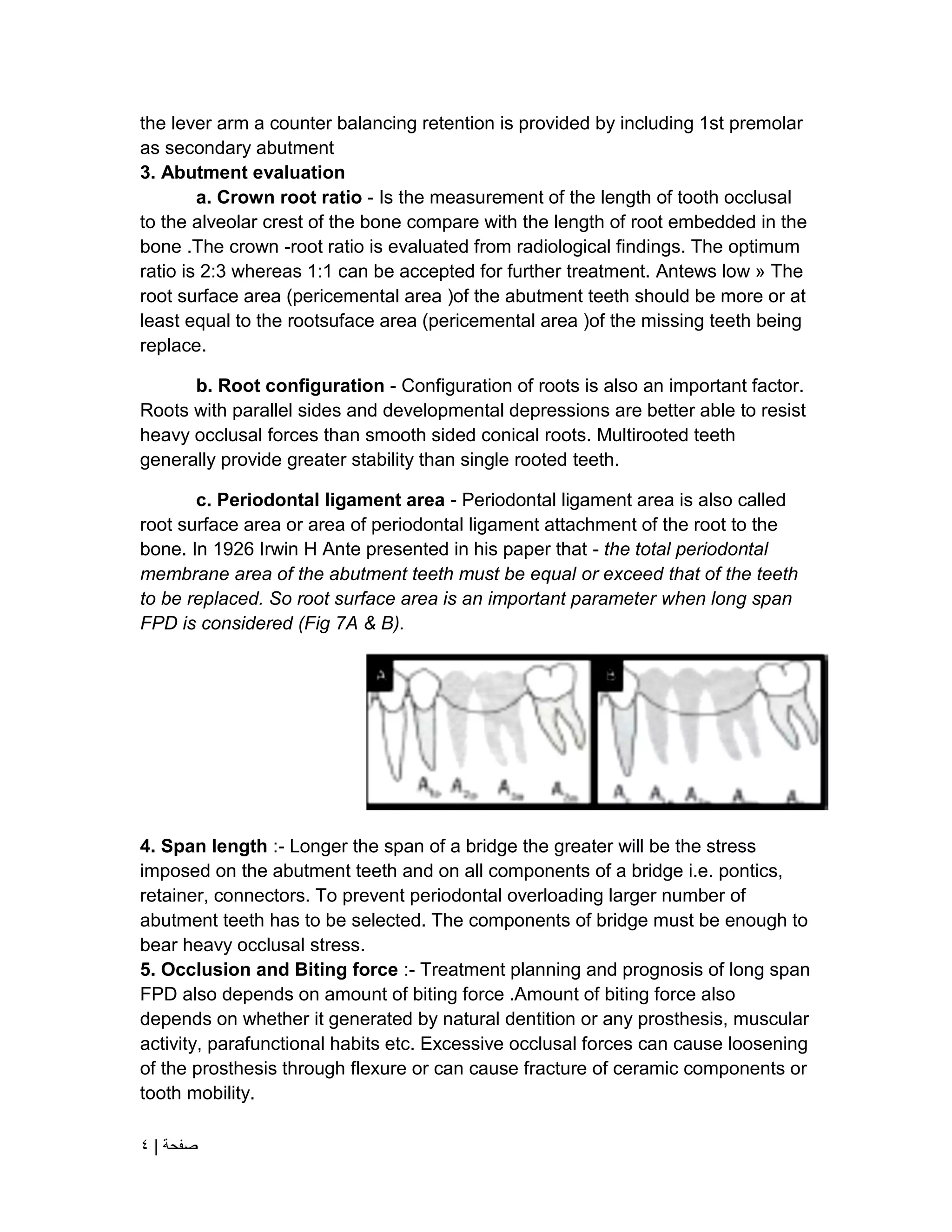 Bridge and Pontic Design .pdf