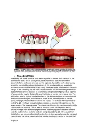 Bridge and Pontic Design .pdf
