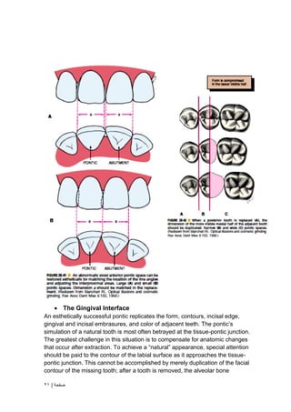 Bridge and Pontic Design .pdf