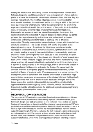 Bridge and Pontic Design .pdf