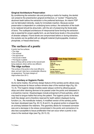 Bridge and Pontic Design .pdf