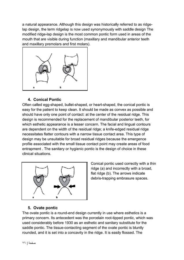 Bridge and Pontic Design .pdf