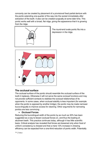 Bridge and Pontic Design .pdf