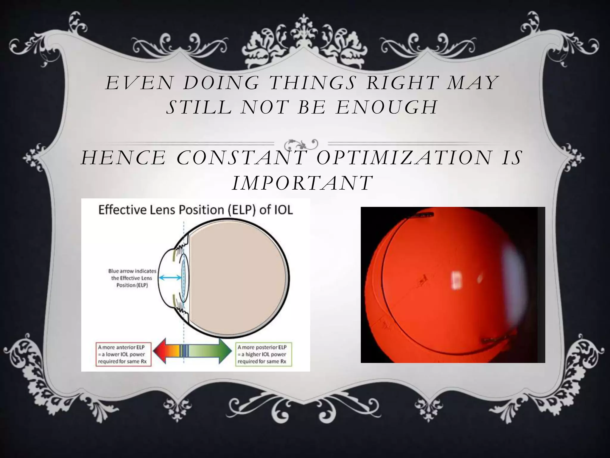 Brief history biometry iol calculation formula & a constant ...