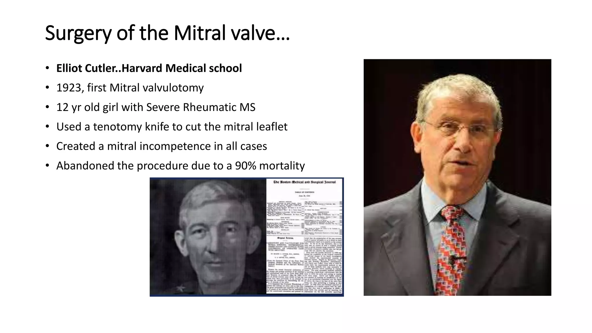Brief history of cardiac surgery | PPTX