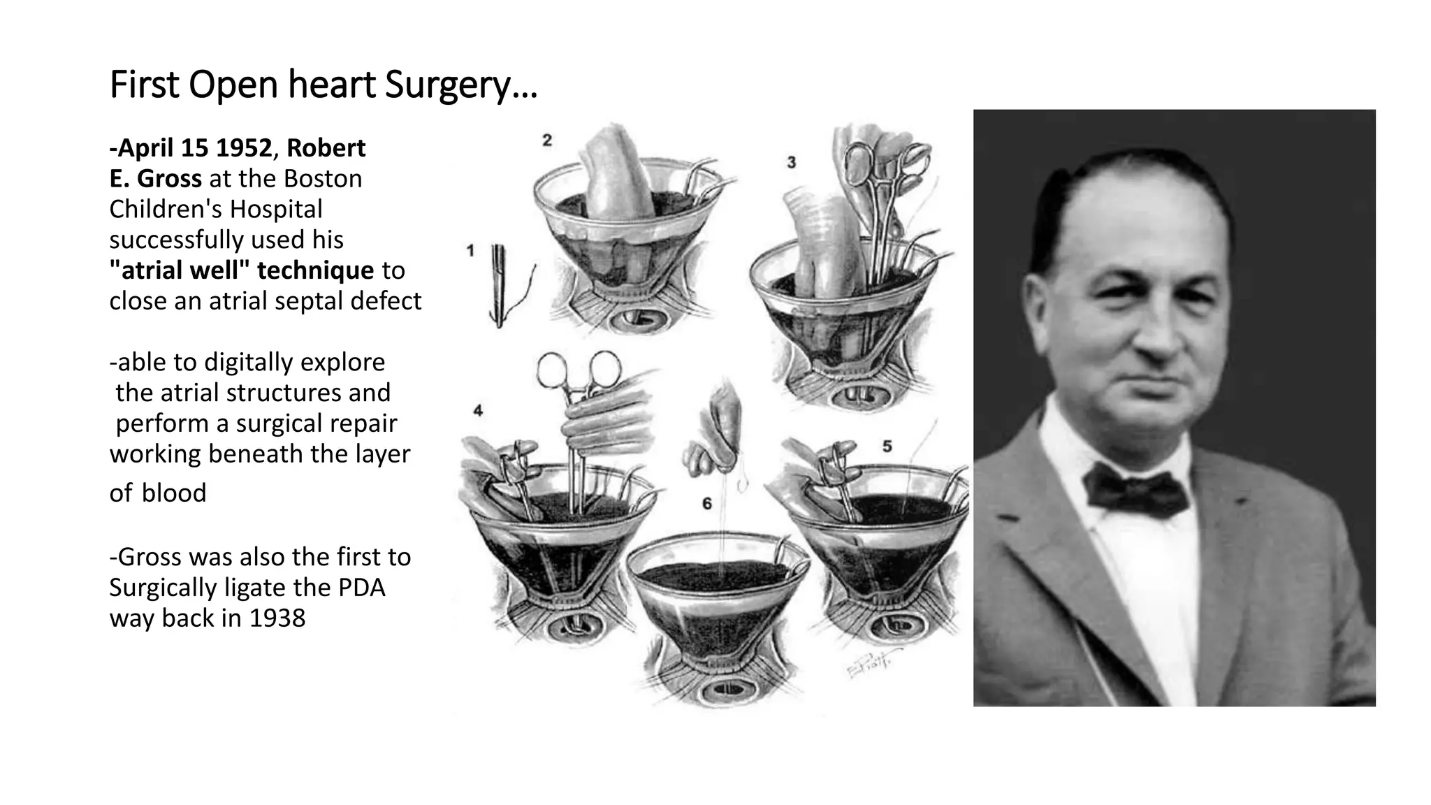 Brief history of cardiac surgery | PPTX