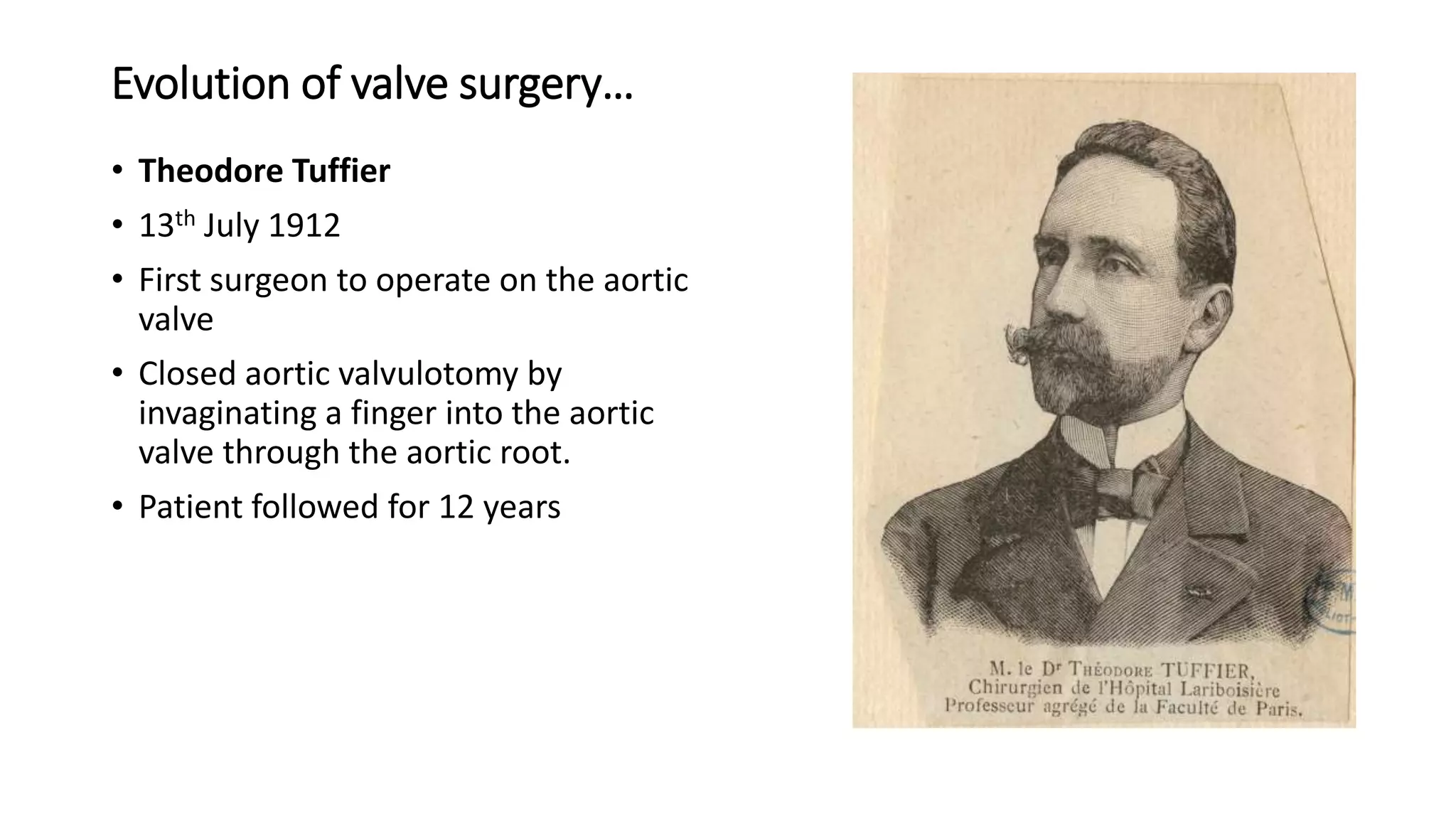 Brief history of cardiac surgery | PPTX
