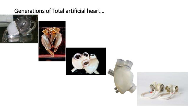 Brief history of cardiac surgery | PPTX | Heart and Cardiovascular ...