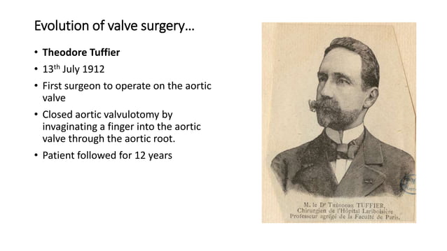 Brief history of cardiac surgery | PPTX | Heart and Cardiovascular ...