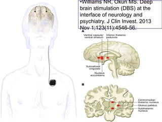 Brief overview of brain stimulation techniques | PPTX