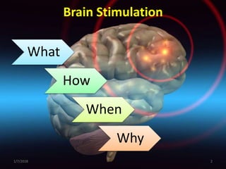 Brief overview of brain stimulation techniques | PPTX