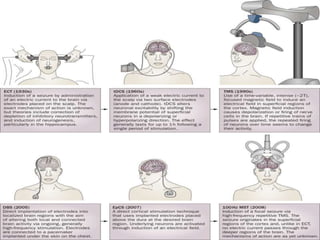 Brief overview of brain stimulation techniques | PPTX
