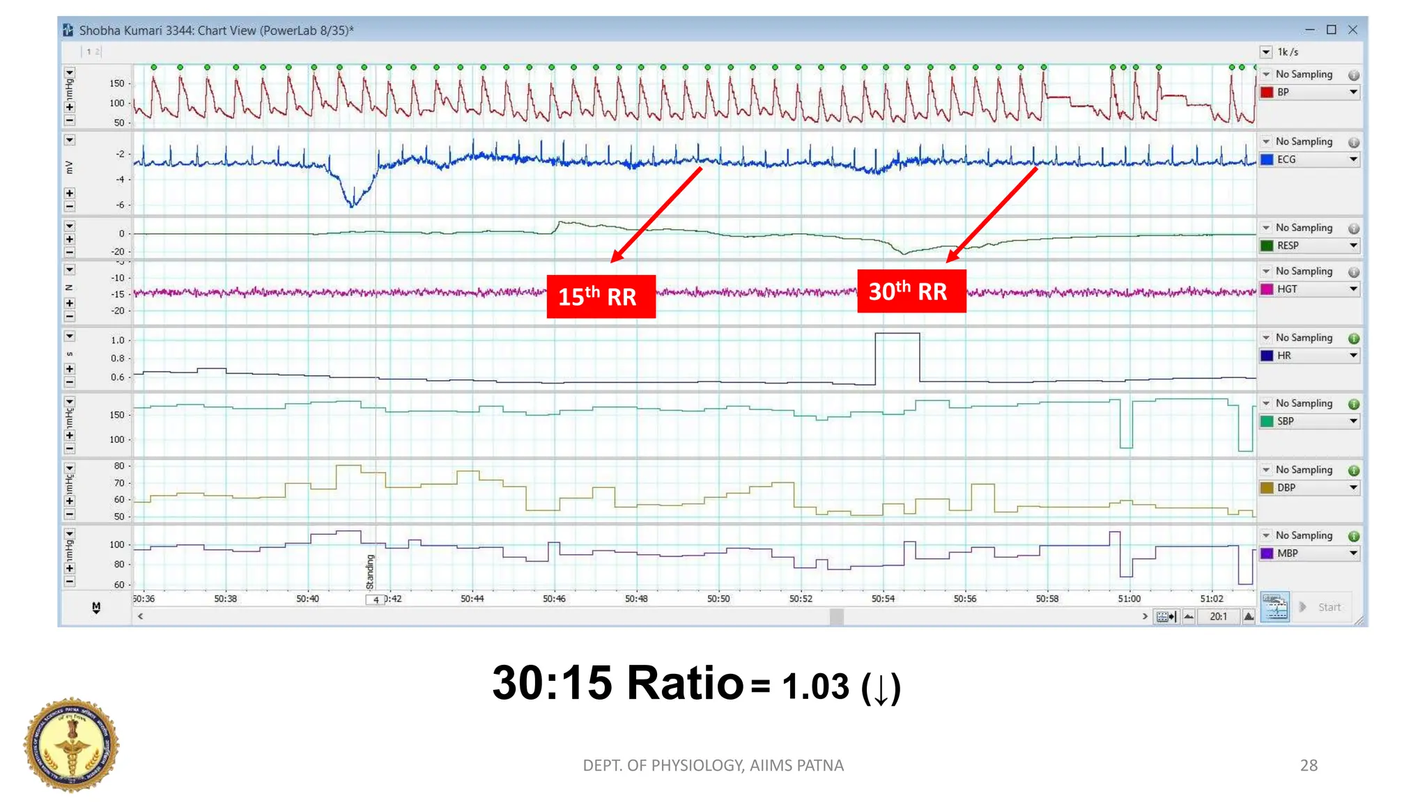 Brief Overview of Autonomic Function Tests | PPT