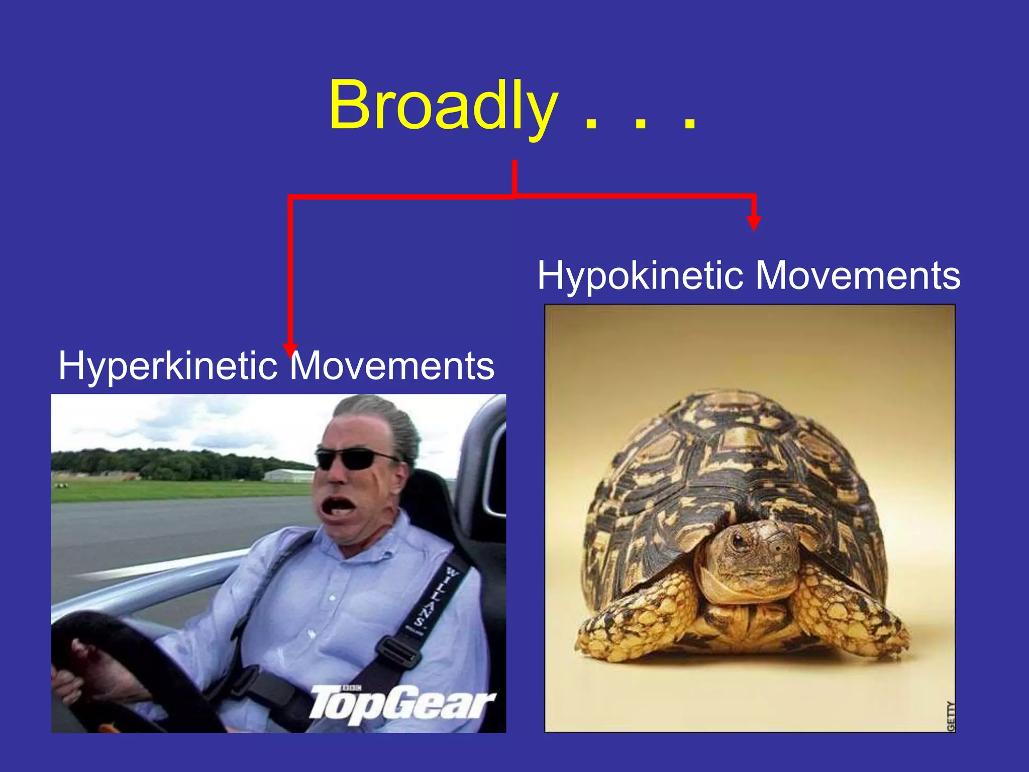 Brief overview of hypokinetic movement disorder | PPT