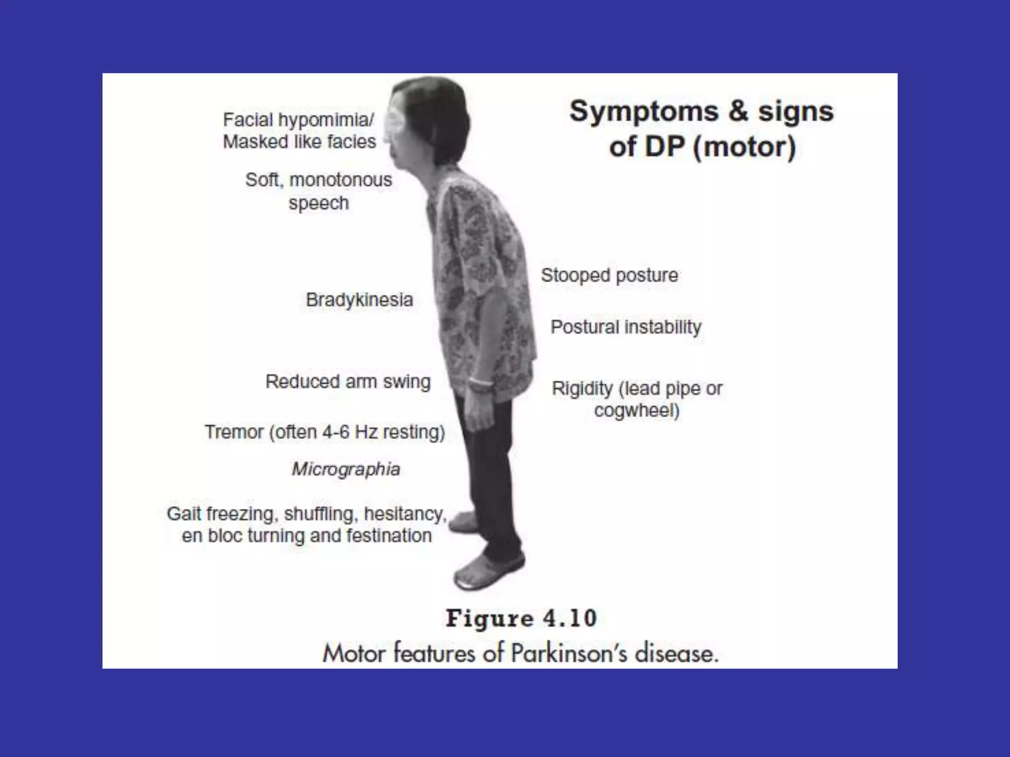 Brief overview of hypokinetic movement disorder | PPT