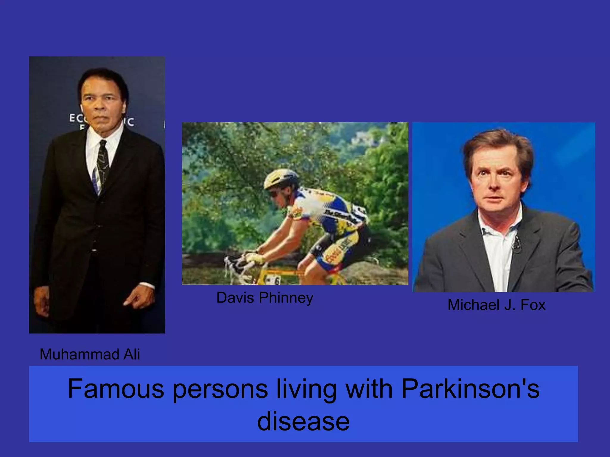 Brief overview of hypokinetic movement disorder | PPT