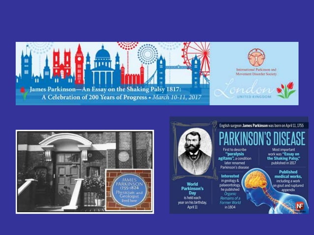 Brief overview of hypokinetic movement disorder | PPT