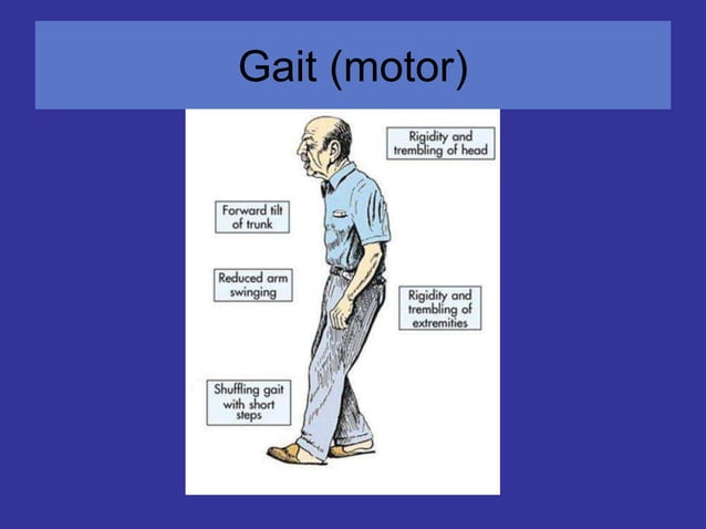 Brief overview of hypokinetic movement disorder | PPT