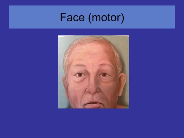 Brief overview of hypokinetic movement disorder | PPT