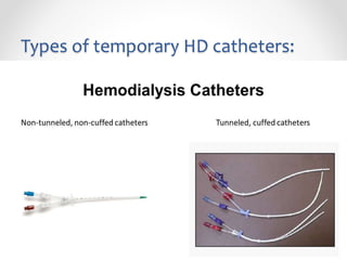 Brief pathway to handle temporary HD catheter | PPTX