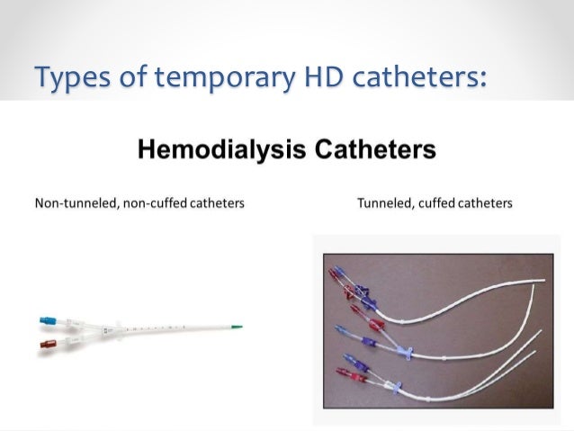 Dialysis Catheter Types