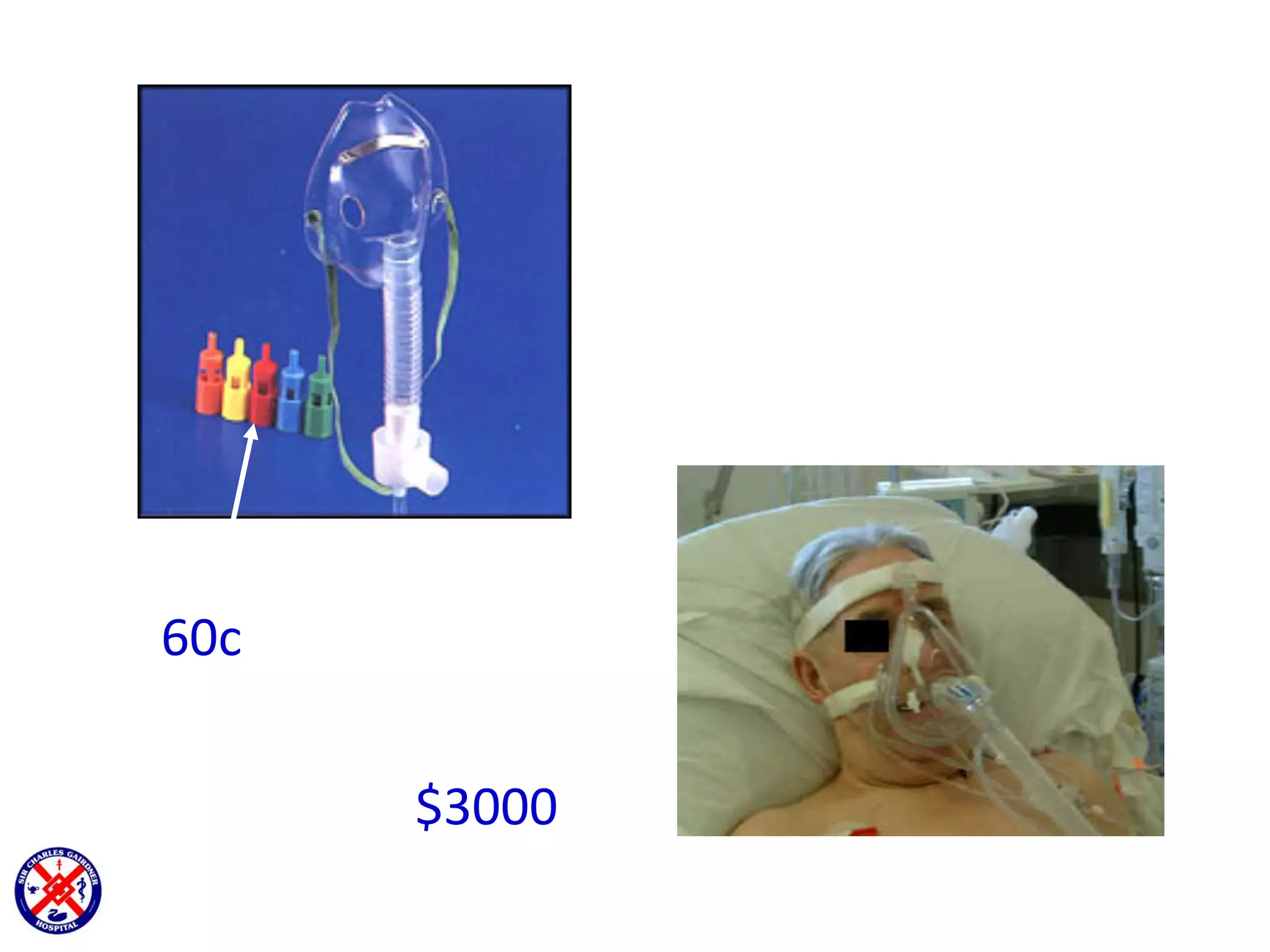 NIV in Acute Exacerbation of COPD | PDF