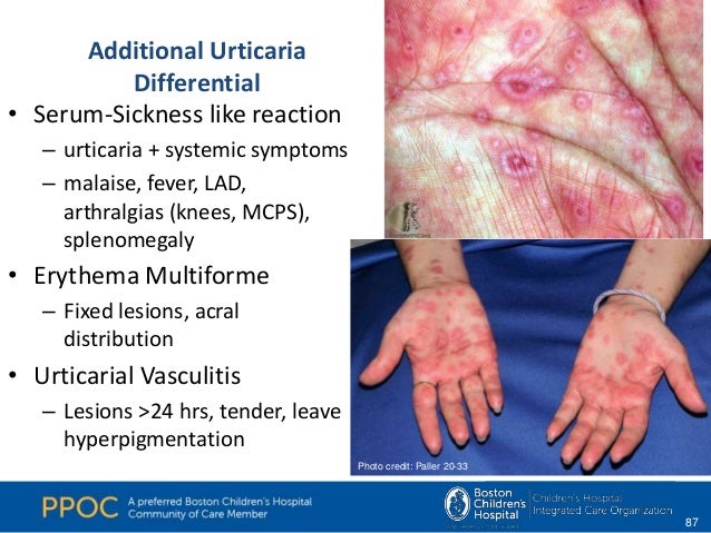 Bringing basic dermatology to the pediatric medical home session 3 wa…