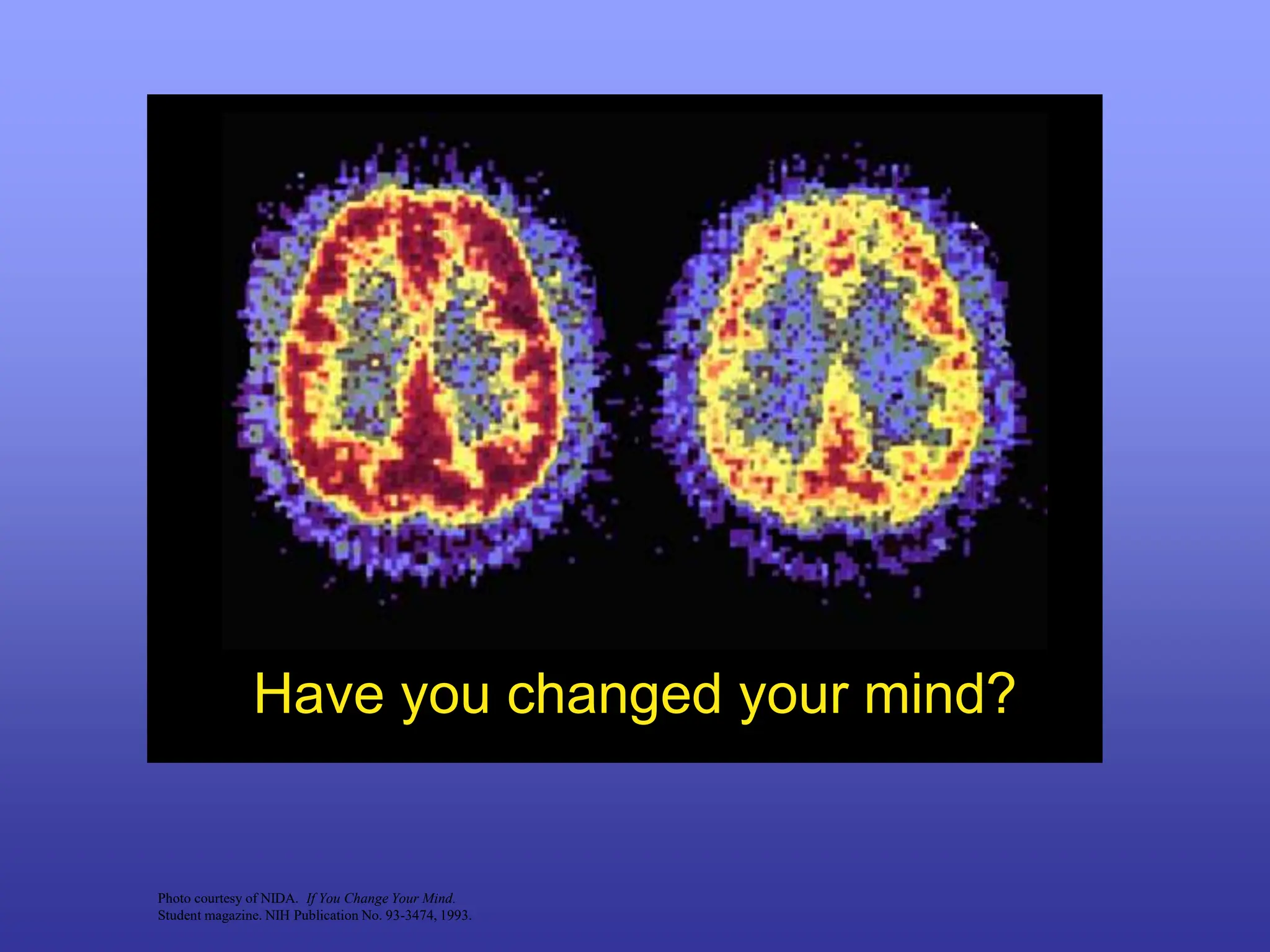 Neuroscience of drug abuse and drug addiction | PPT