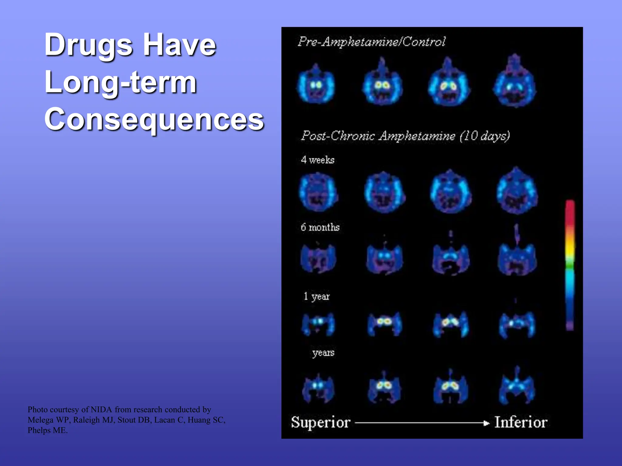Neuroscience of drug abuse and drug addiction | PPT