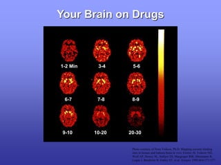 Neuroscience of drug abuse and drug addiction | PPT