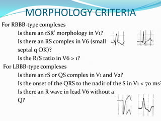 Broad complex tachycardia | PPT
