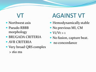 Broad complex tachycardia | PPT
