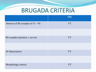 Broad complex tachycardia | PPT