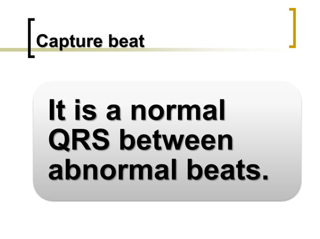 Broad complex tachycardia | PPT