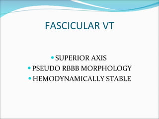 ECG: Wide Complex Tachycardia | PPT