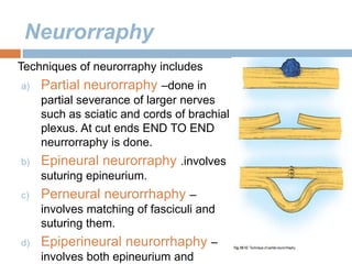 Broad frame work of management in peripheral nerve | PPTX