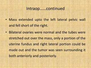 Broad ligament fibroid | PPTX