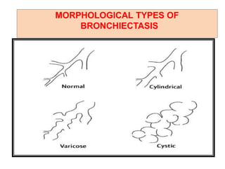 CHAPTER-IV RESPIRATORY SYSTEM Brochiectasis - .ppt