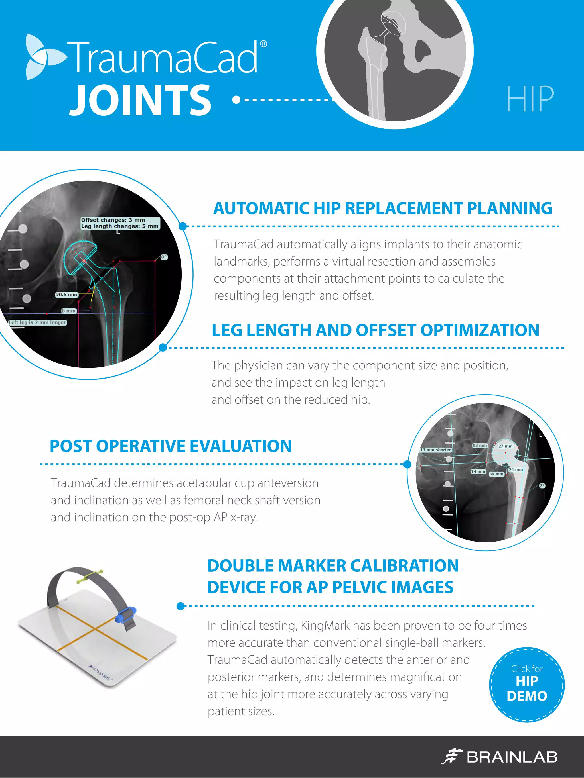 Brochure TraumaCad 2.4 Joints | PDF