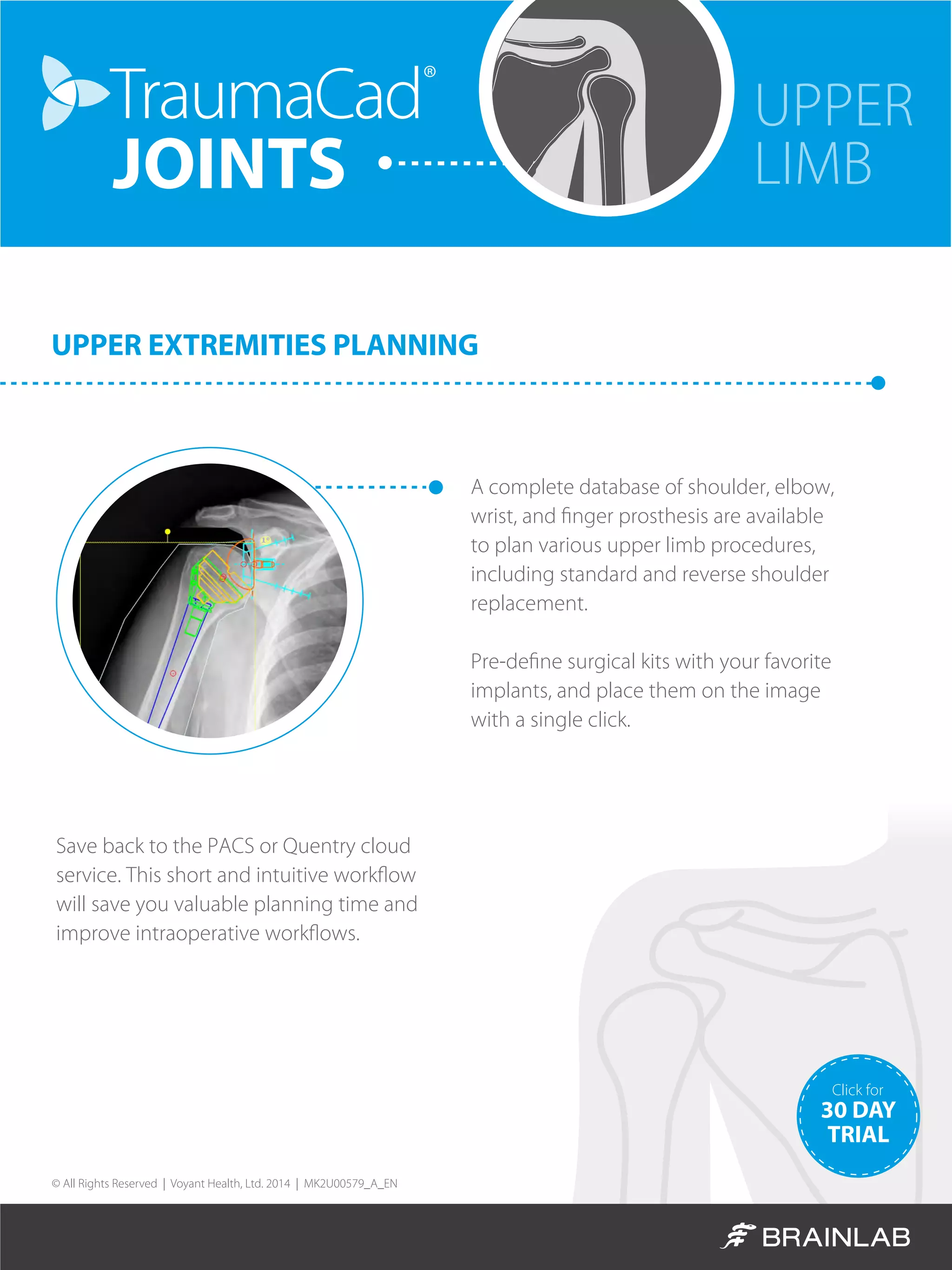 Brochure TraumaCad 2.4 Joints | PDF