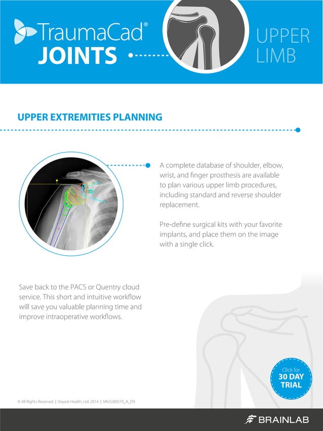 Brochure TraumaCad 2.4 Joints | PDF
